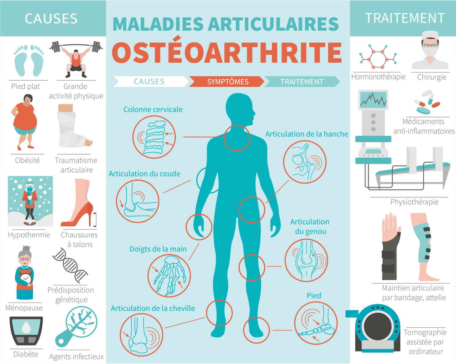 Arthrose : traitements et prévention de la maladie articulaire ...