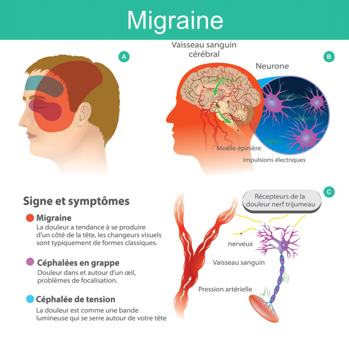 Comprendre Les Causes, Symptômes Et Traitements – BDNE